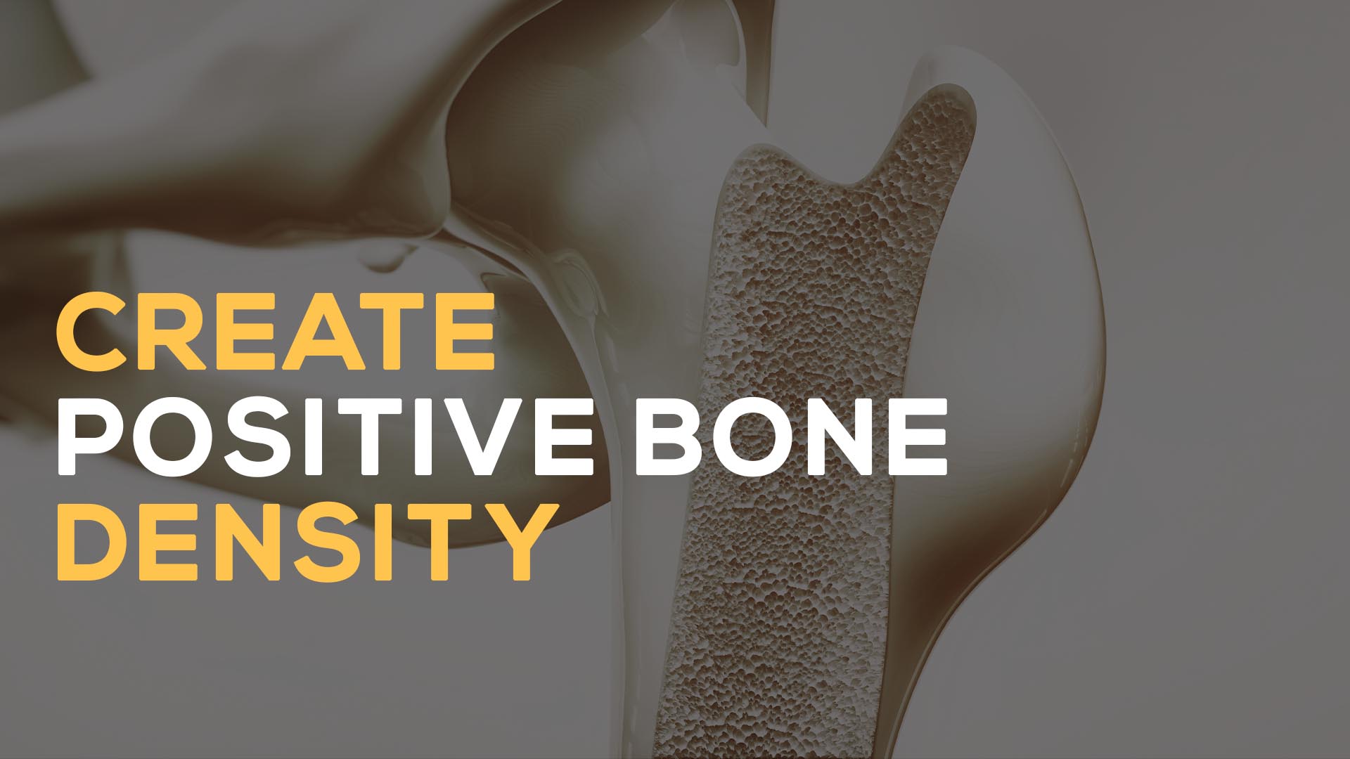 Create Positive Bone Density - OsteoStrong